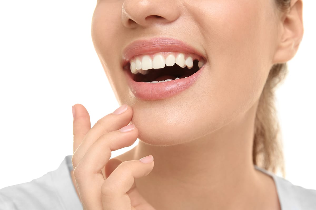 Does Your Smile Have A Missing Tooth Choice Dental