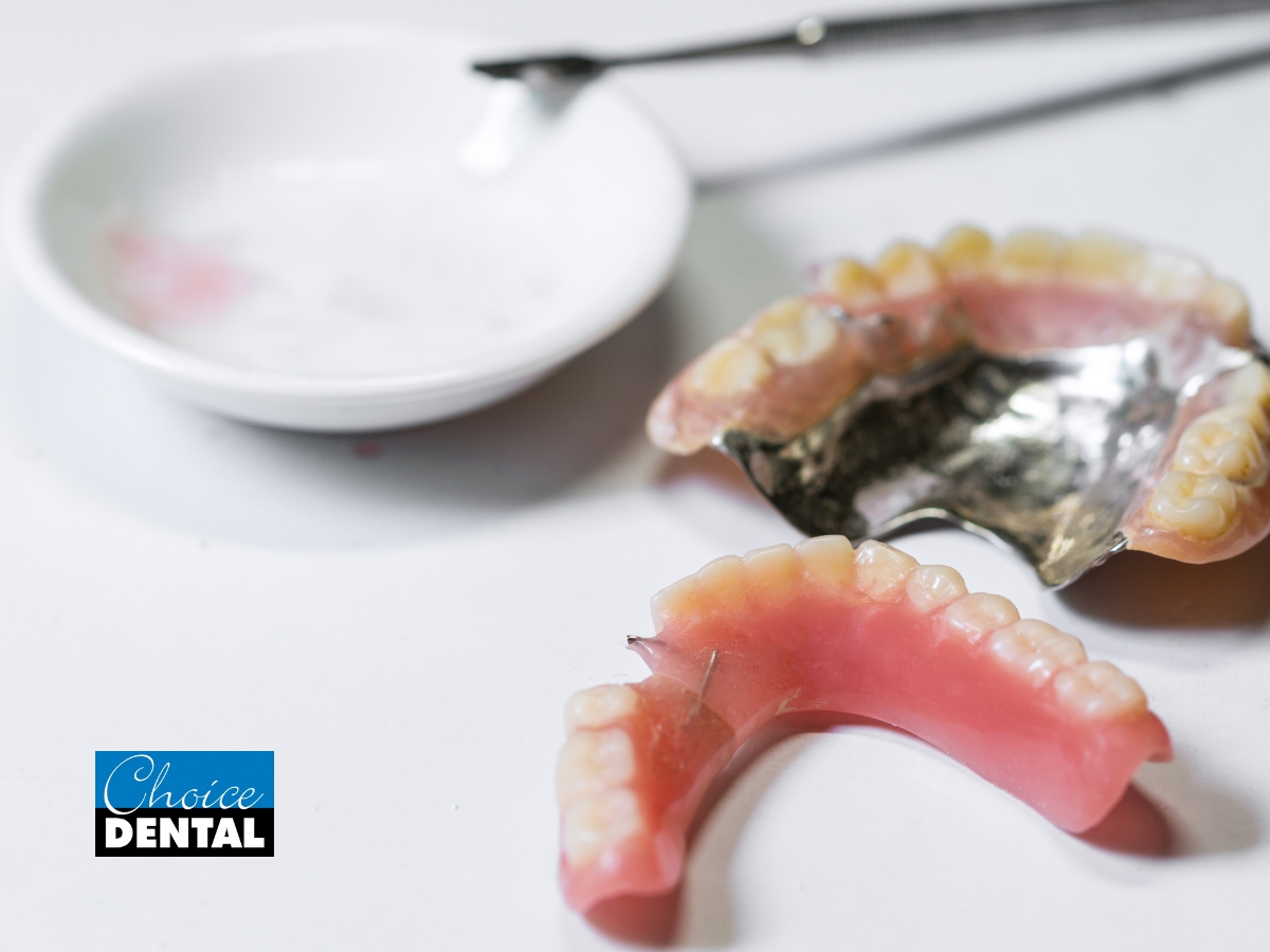 Denture Repair Services: Care Tips for Longevity